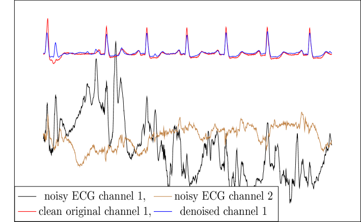 [1212.5217] A Neural Network Approach to ECG Denoising