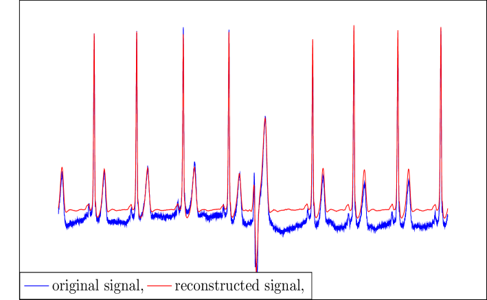 [1212.5217] A Neural Network Approach to ECG Denoising
