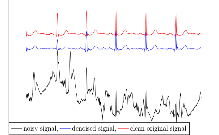 [1212.5217] A Neural Network Approach to ECG Denoising