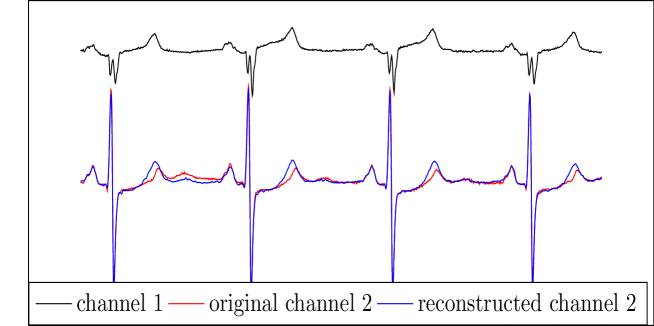 [1212.5217] A Neural Network Approach to ECG Denoising