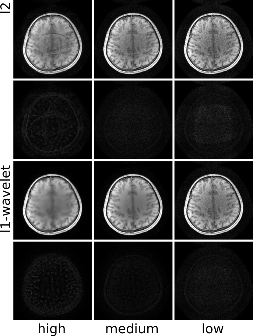 [1501.06209] Parallel Magnetic Resonance Imaging
