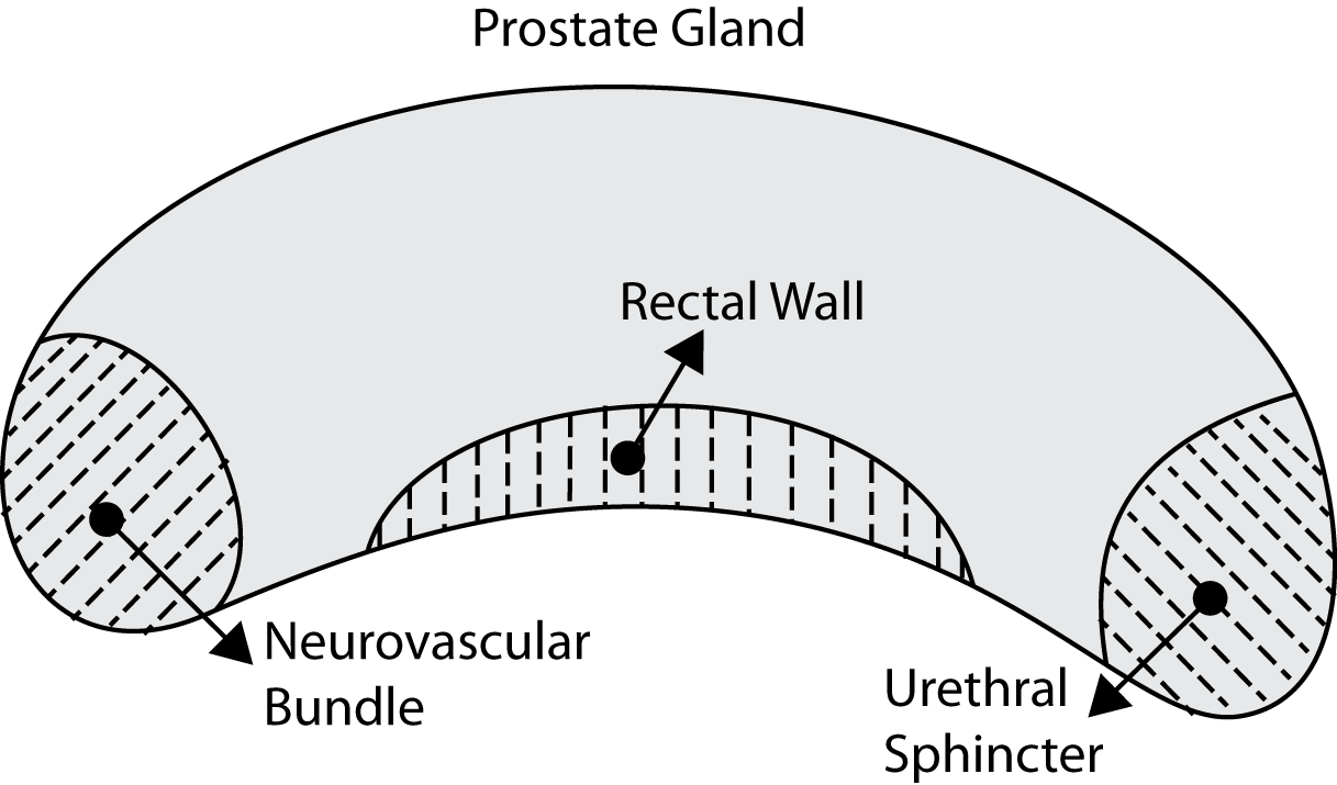 [1604.04678] Anatomy-Aware Measurement of Segmentation Accuracy