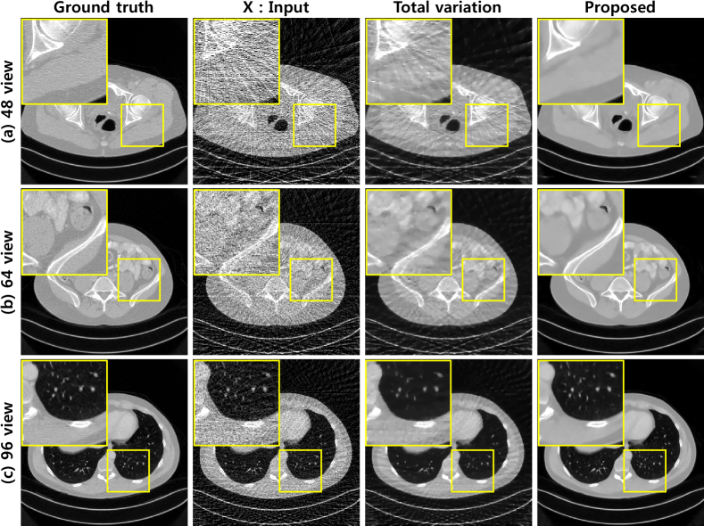 [1611.06391] Deep Residual Learning for Compressed Sensing CT Reconstruction via Persistent ...