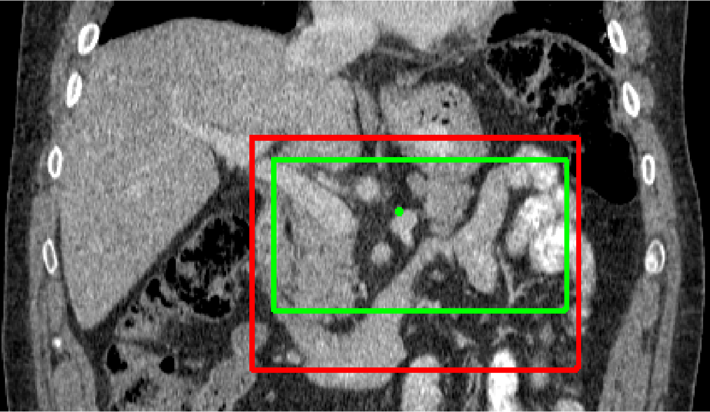 [1702.00045] Spatial Aggregation of Holistically-Nested Convolutional Neural Networks for ...