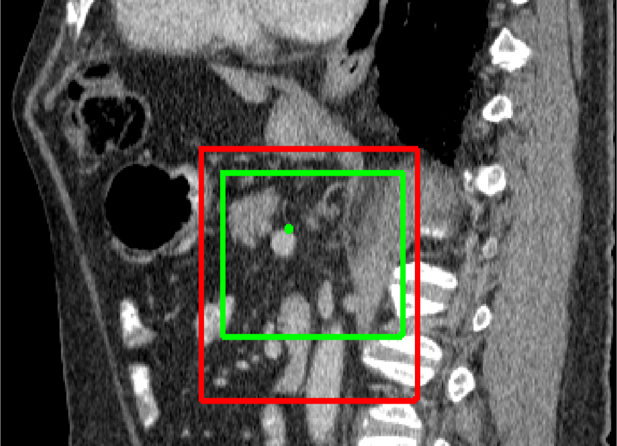[1702.00045] Spatial Aggregation of Holistically-Nested Convolutional Neural Networks for ...