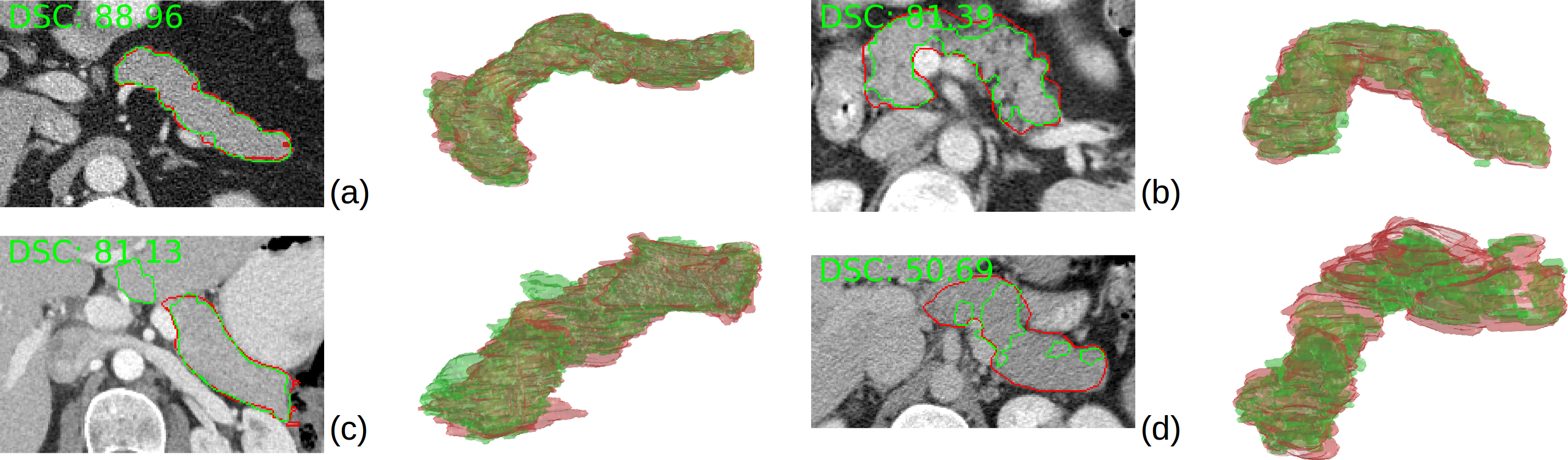 [1702.00045] Spatial Aggregation of Holistically-Nested Convolutional ...