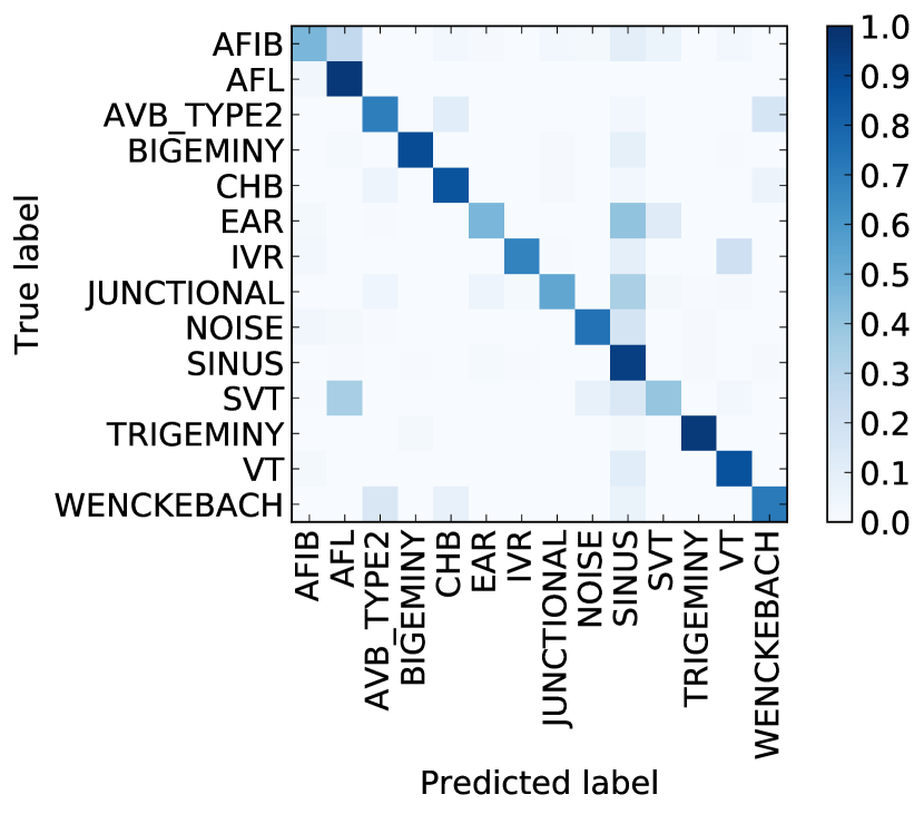 [1707.01836] Cardiologist-Level Arrhythmia Detection with Convolutional Neural Networks