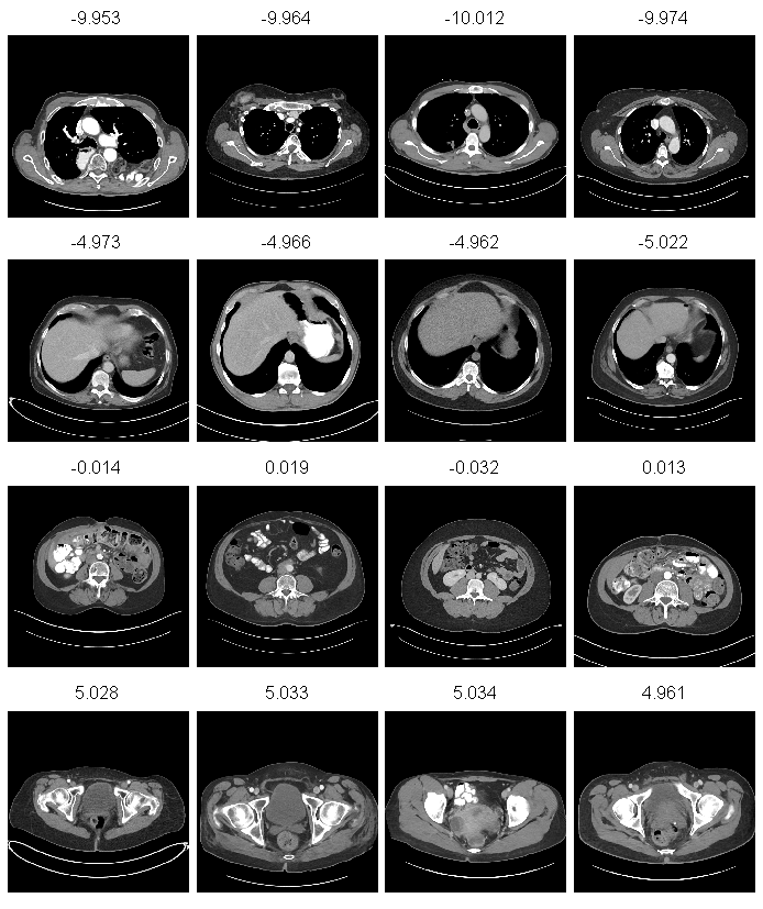 [1707.03891] Unsupervised Body Part Regression via Spatially Self-ordering Convolutional Neural ...