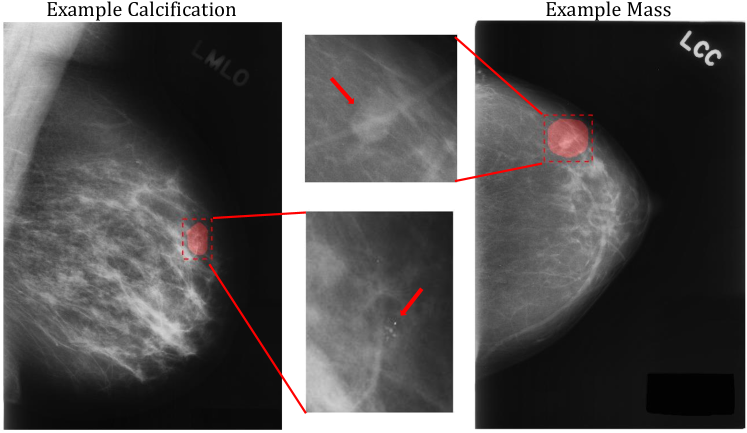 [1707.06978] A Multi-Scale CNN and Curriculum Learning Strategy for ...