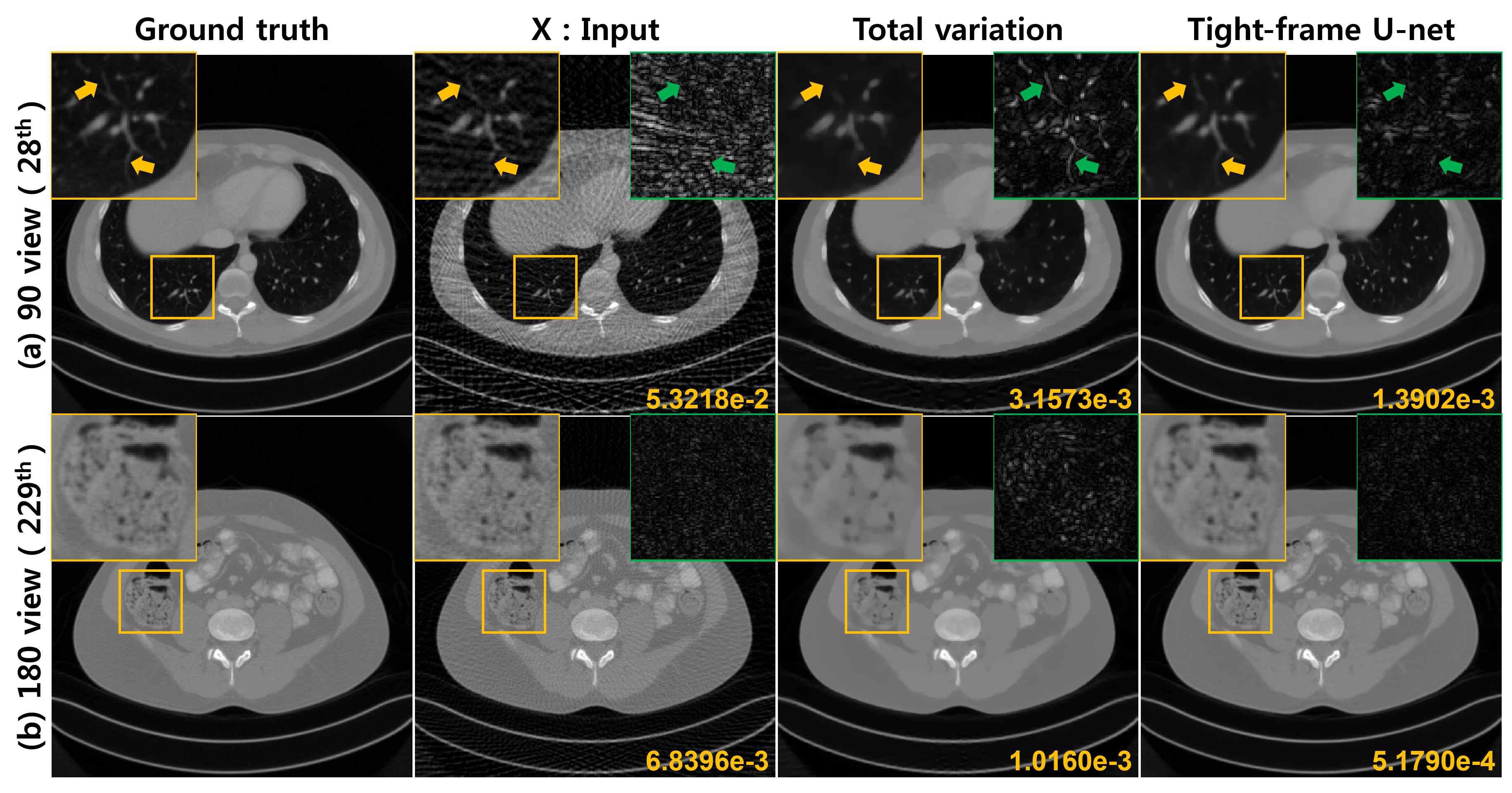 [1708.08333] Framing U-Net via Deep Convolutional Framelets: Application to Sparse-view CT