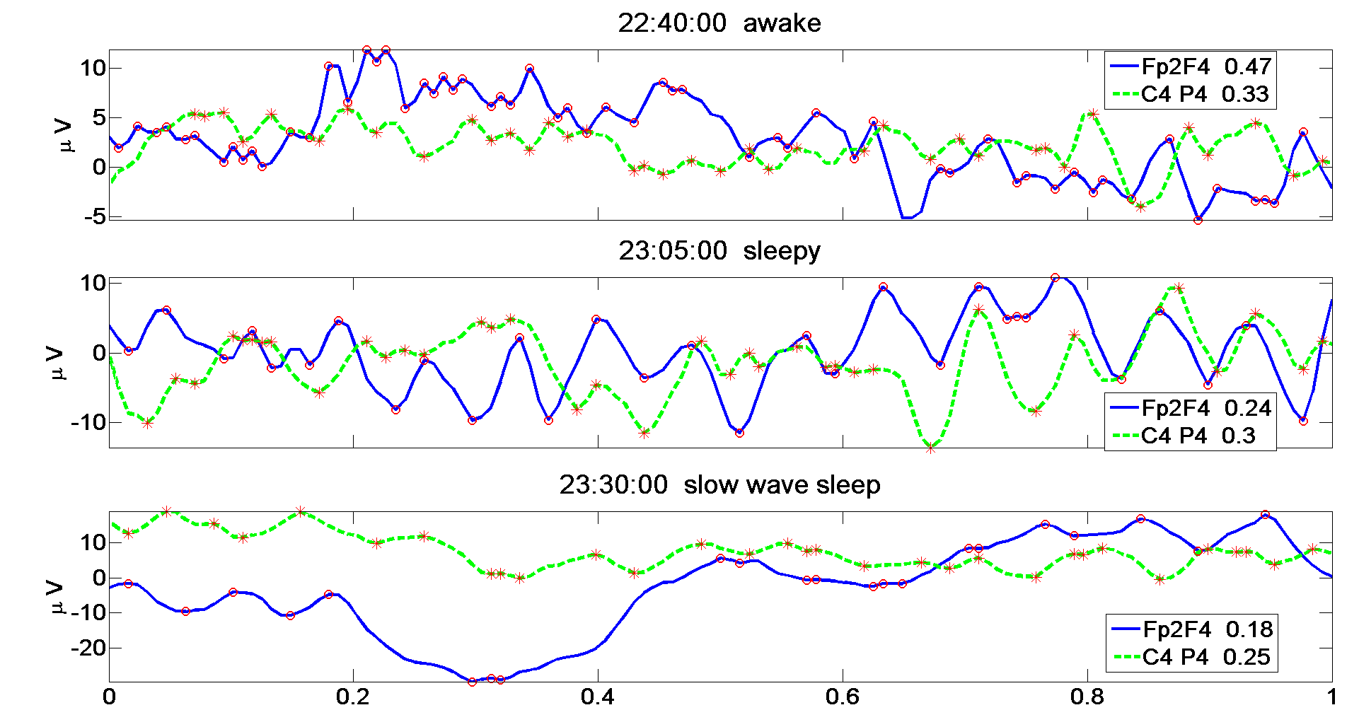 [1710.00559] Crude EEG parameter provides sleep medicine with well ...