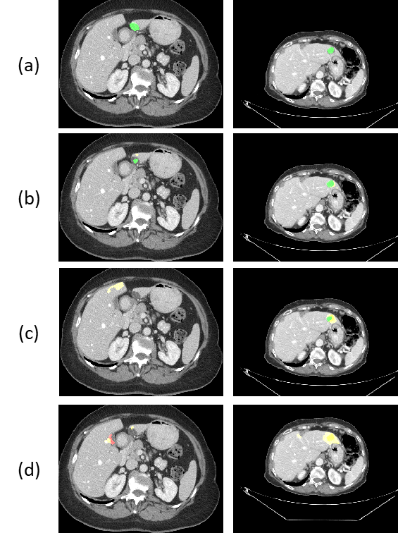 [1801.02261] Anatomical Data Augmentation For CNN based Pixel-wise ...
