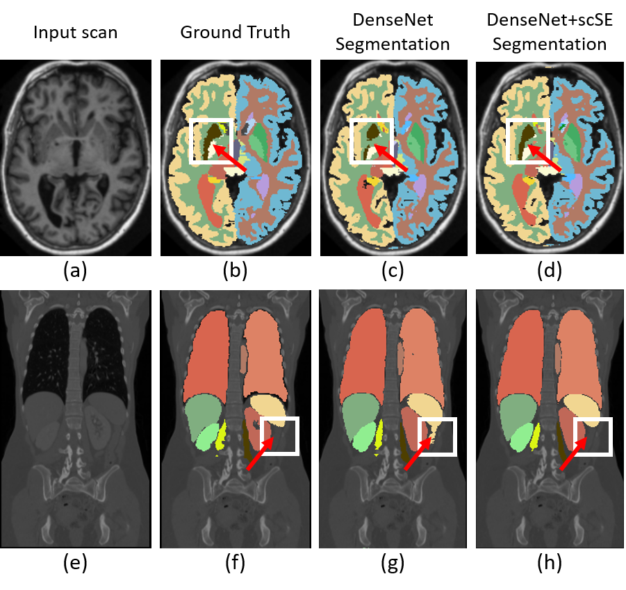 [1803.02579] Concurrent Spatial and Channel ‘Squeeze & Excitation’ in Fully Convolutional Networks