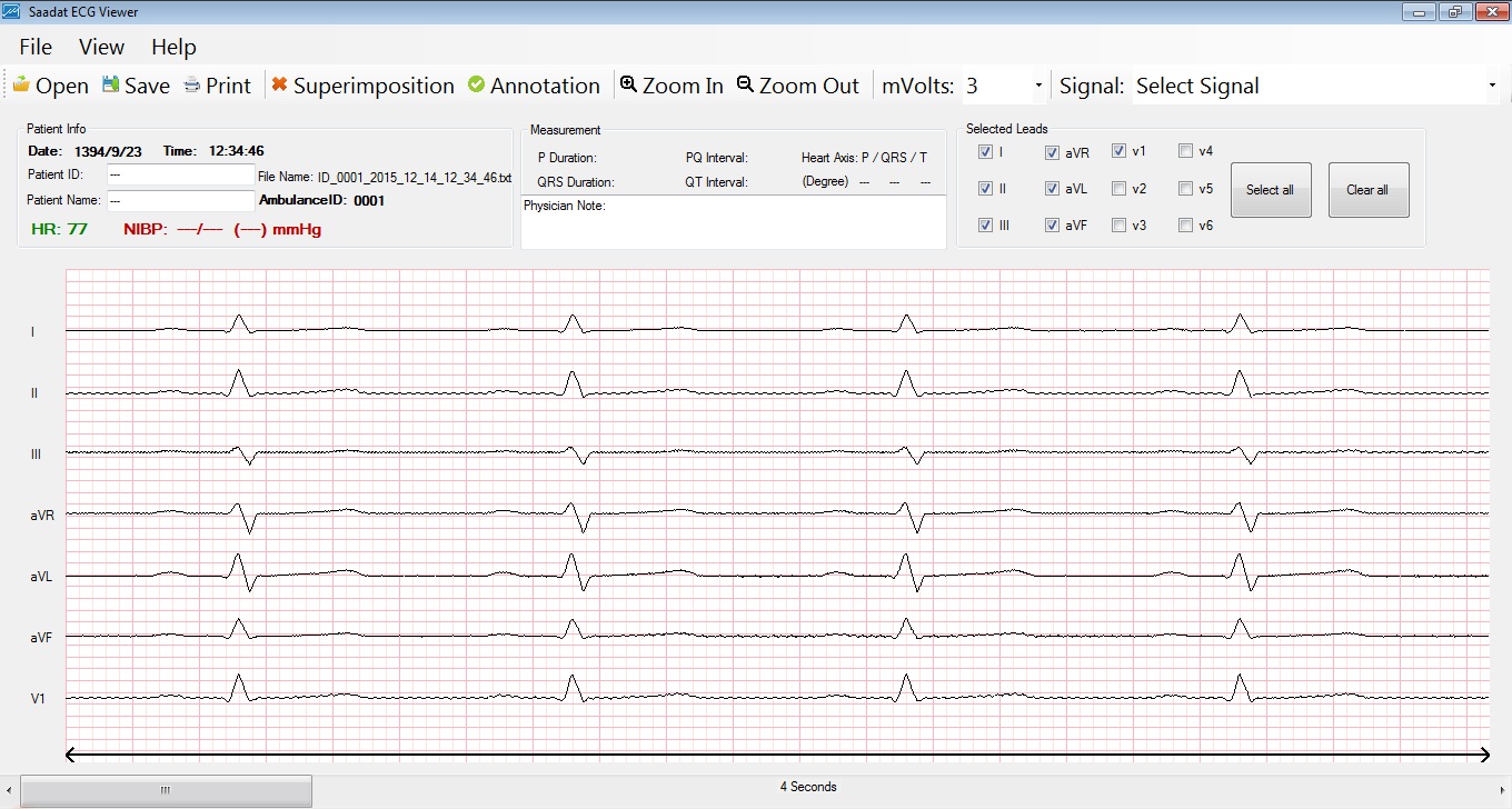 [1805.05913] Pre-Hospital Management of Acute Myocardial Infarction ...