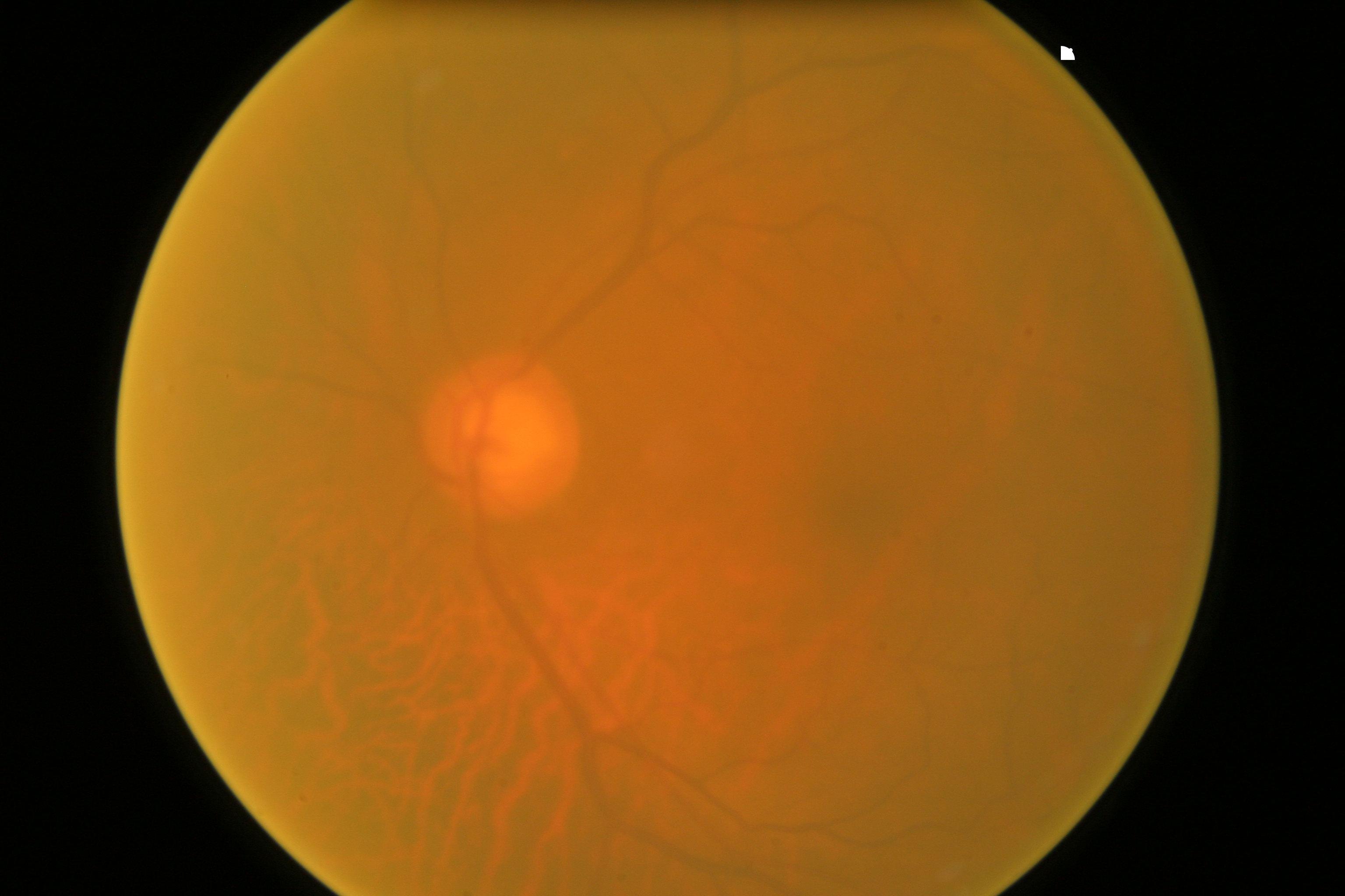 [1805.06625] Structure-preserving Guided Retinal Image Filtering and ...
