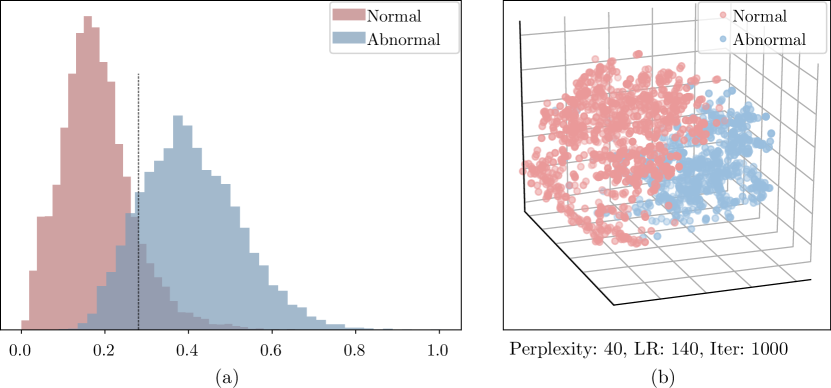 [1805.06725] GANomaly: Semi-Supervised Anomaly Detection via ...