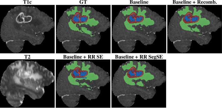 [1806.02318] Adaptive feature recombination and recalibration for ...