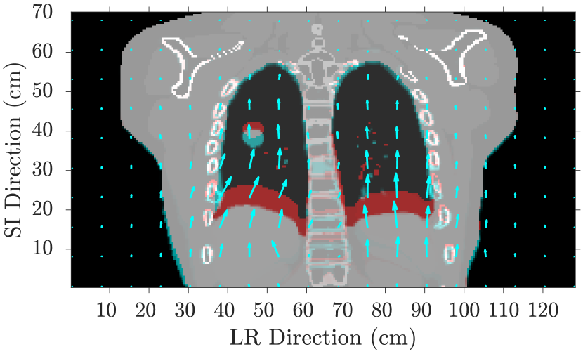[1808.08310] Continuous Generation of Volumetric Images During Stereotactic Body Radiation ...