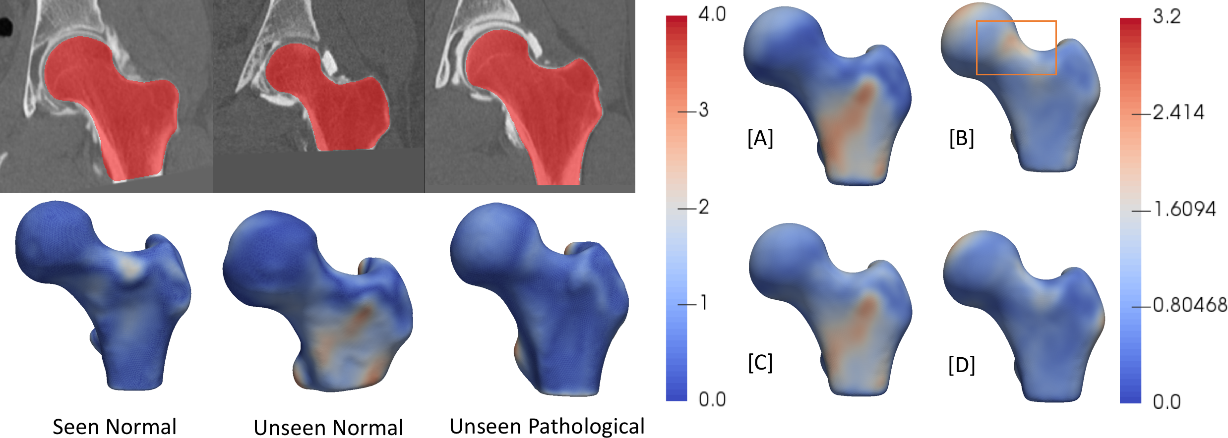 [1810.00111] DeepSSM: A Deep Learning Framework for Statistical Shape Modeling from Raw Images