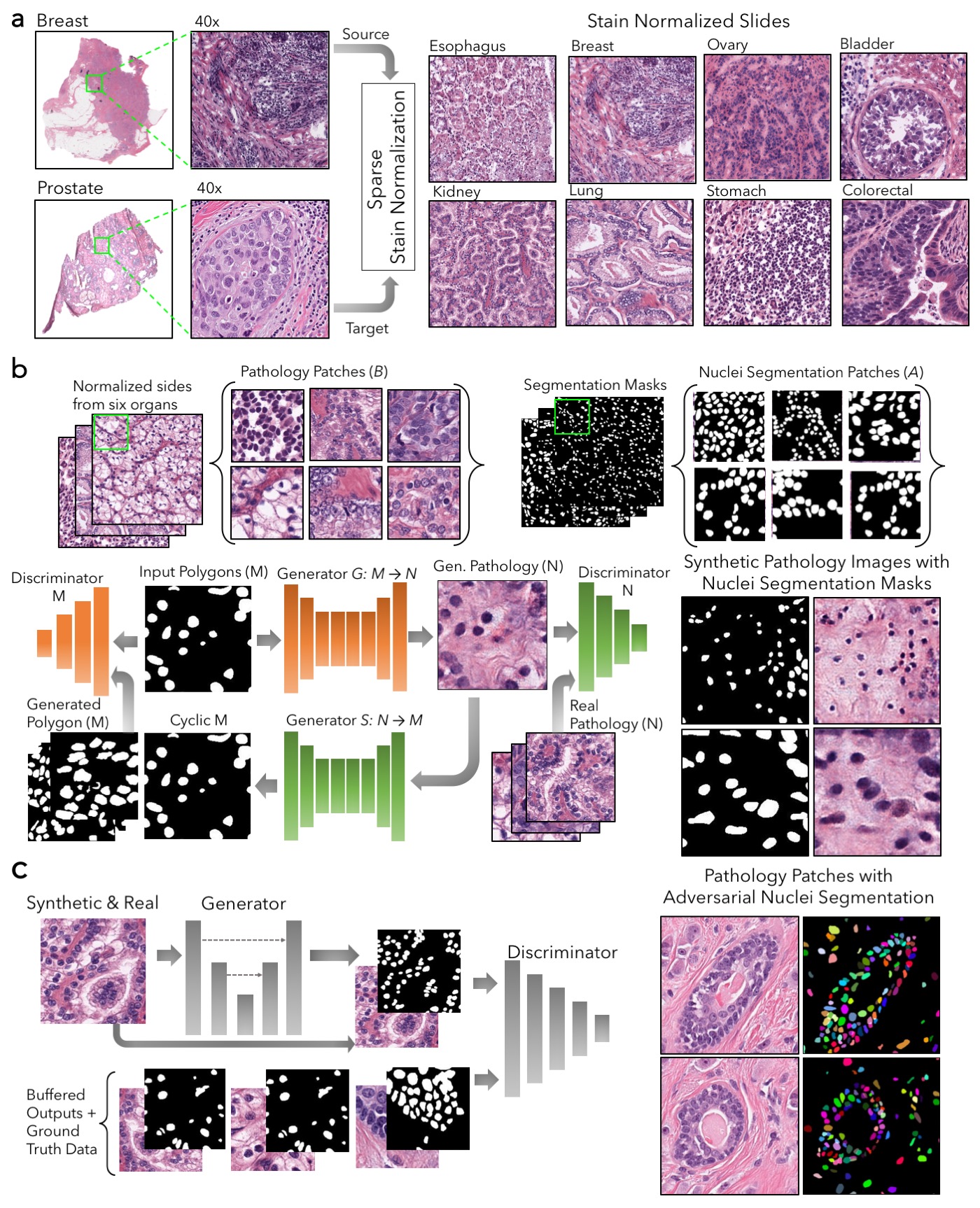 [1810.00236] Deep Adversarial Training for Multi-Organ Nuclei ...
