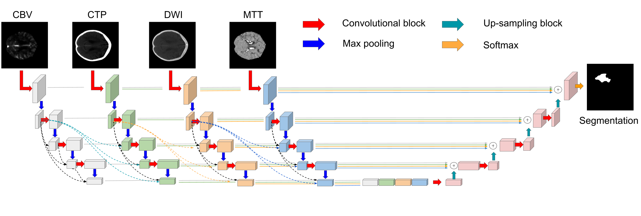 [1810.07003] Dense Multi-path U-Net for Ischemic Stroke Lesion Segmentation in Multiple Image ...
