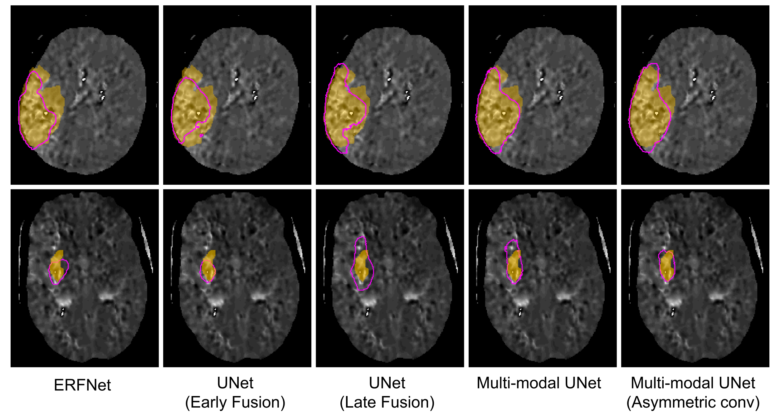 [1810.07003] Dense Multi-path U-Net for Ischemic Stroke Lesion Segmentation in Multiple Image ...