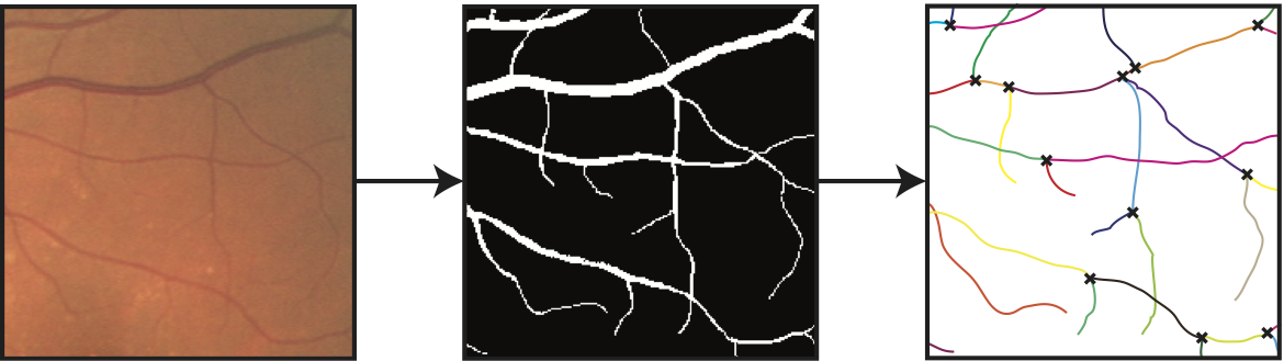 [1811.03208] Deep Semantic Instance Segmentation of Tree-like Structures Using Synthetic Data