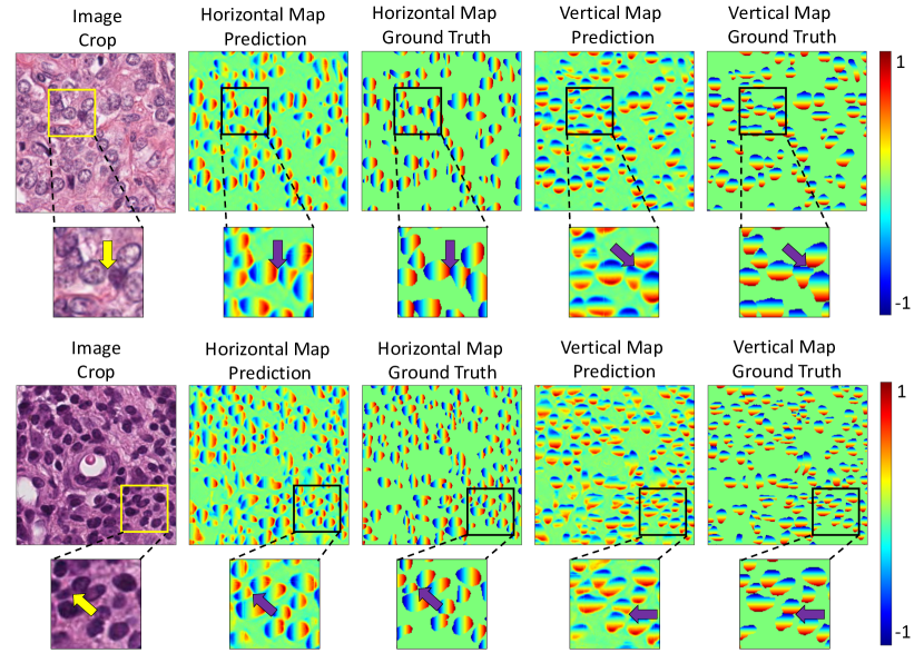 [1812.06499] HoVer-Net: Simultaneous Segmentation and Classification of Nuclei in Multi-Tissue ...