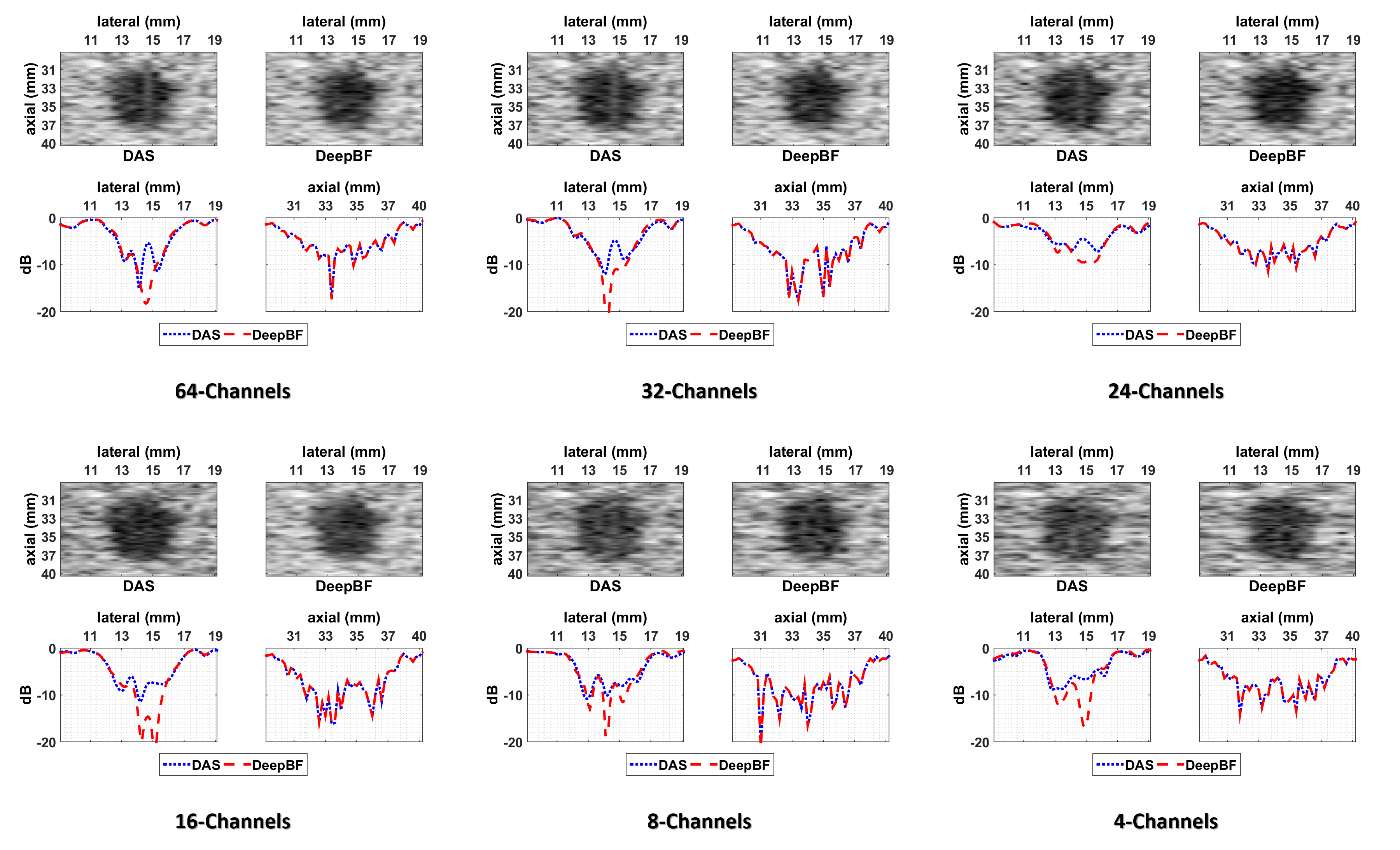 [1901.01706] Universal Deep Beamformer for Variable Rate Ultrasound Imaging