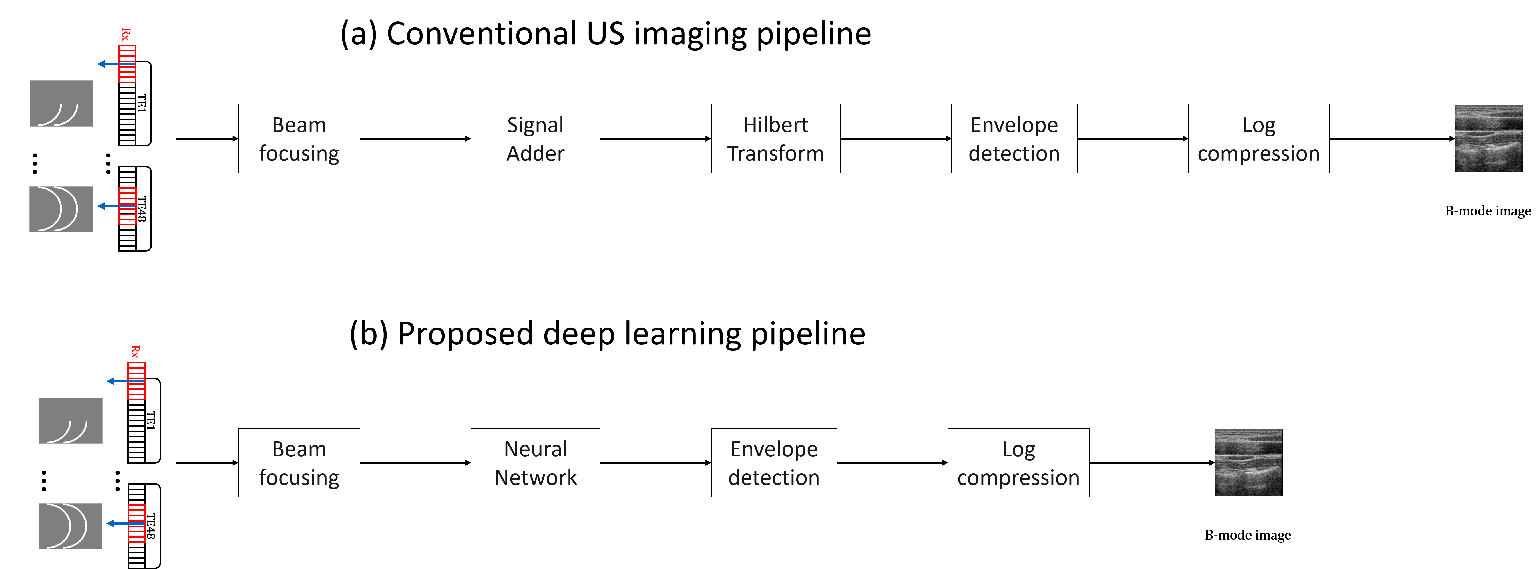 [1901.01706] Universal Deep Beamformer for Variable Rate Ultrasound Imaging