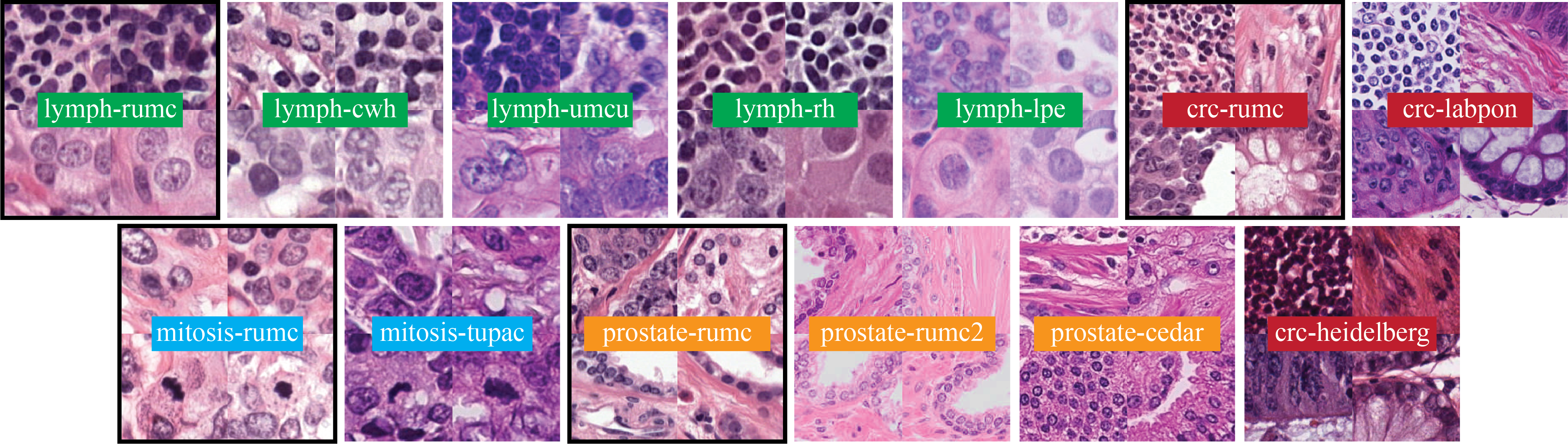 [1902.06543] Quantifying the effects of data augmentation and stain color normalization in ...
