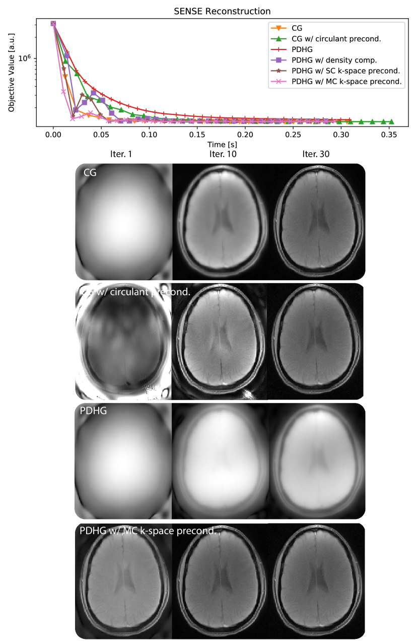 [1902.09657] Accelerating Non-Cartesian MRI Reconstruction Convergence ...