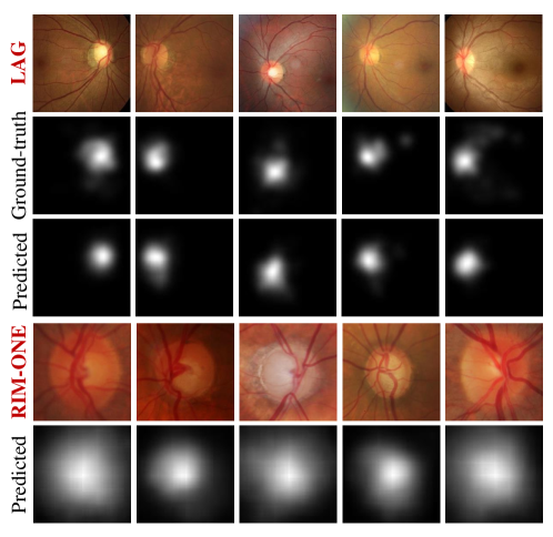 [1903.10831] Attention Based Glaucoma Detection: A Large-scale Database ...