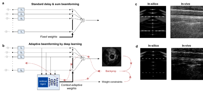 [1907.02994] Deep learning in Ultrasound Imaging