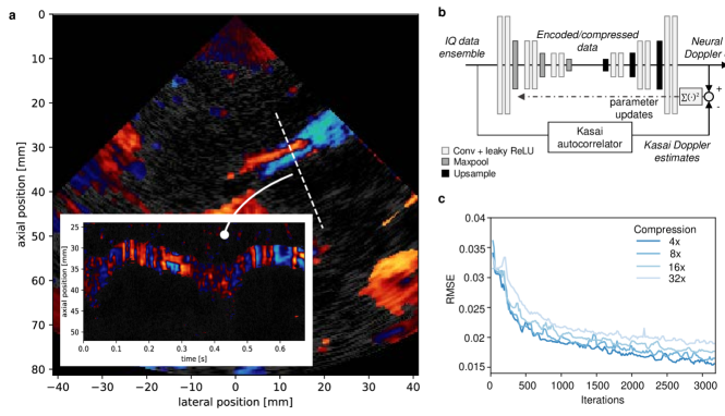 [1907.02994] Deep learning in Ultrasound Imaging