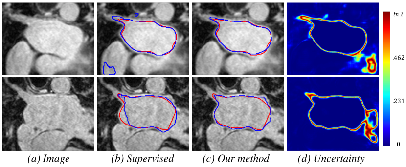 [1907.07034] Uncertainty-aware Self-ensembling Model for Semi-supervised 3D Left Atrium Segmentation