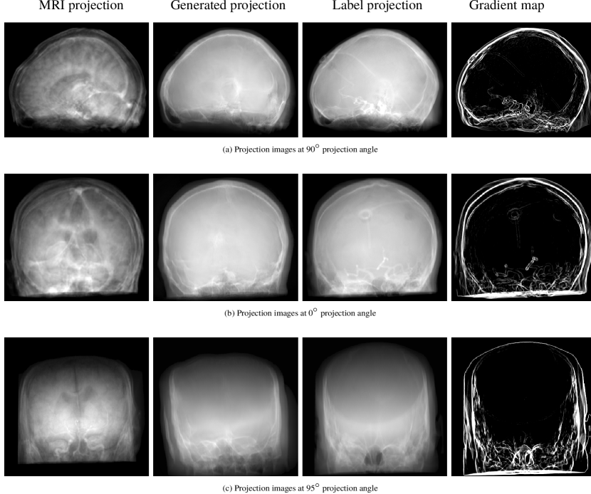 [1911.08163] Projection-to-Projection Translation for Hybrid X-ray and ...