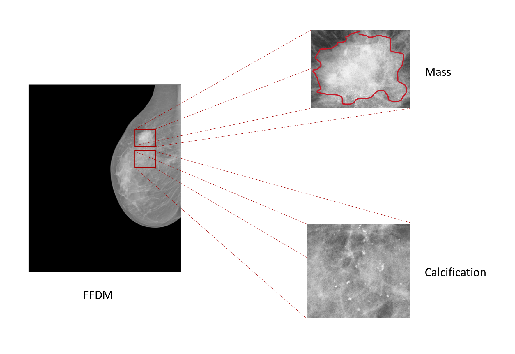 [1912.07517] Zoom in to where it matters: a hierarchical graph based ...