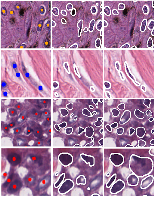 [2003.10778] PanNuke Dataset Extension, Insights and Baselines