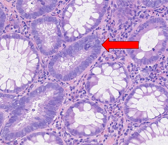 [2003.10778] PanNuke Dataset Extension, Insights and Baselines