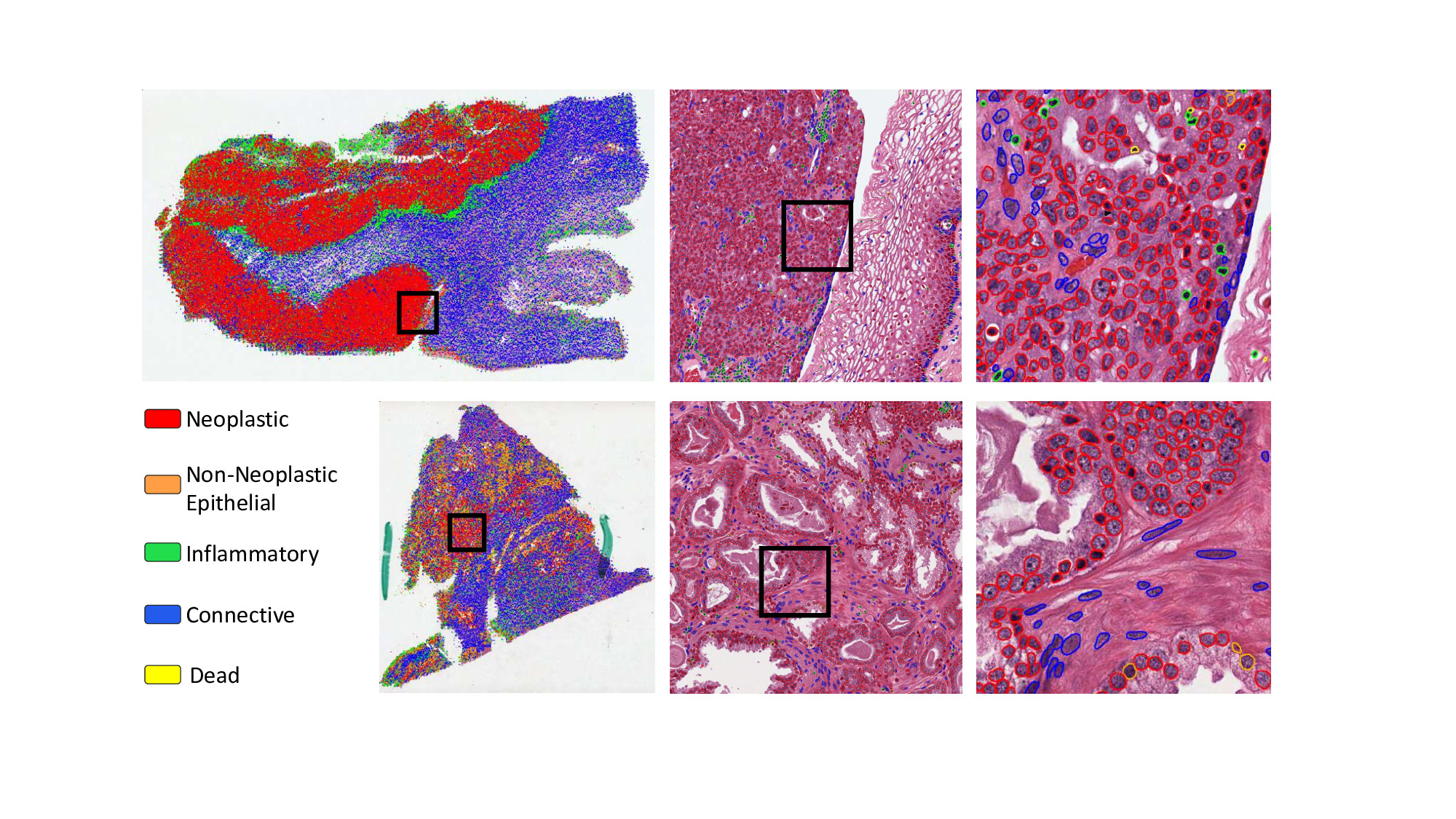 [2003.10778] PanNuke Dataset Extension, Insights and Baselines