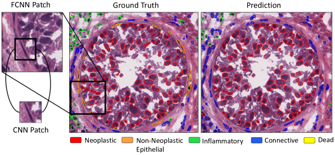 [2003.10778] PanNuke Dataset Extension, Insights and Baselines