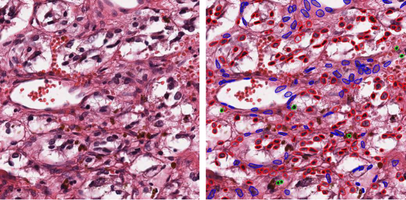 [2003.10778] PanNuke Dataset Extension, Insights and Baselines