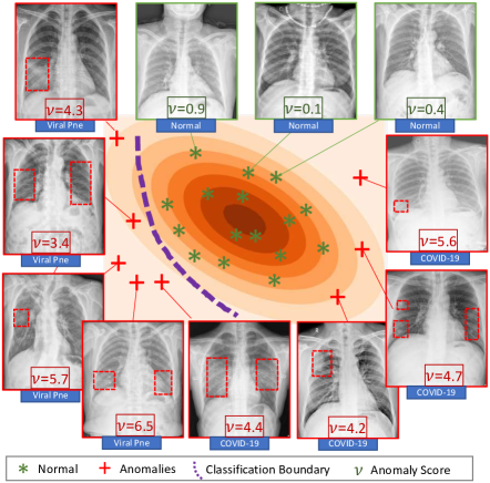 [2003.12338] Viral Pneumonia Screening on Chest X-rays Using Confidence-Aware Anomaly Detection
