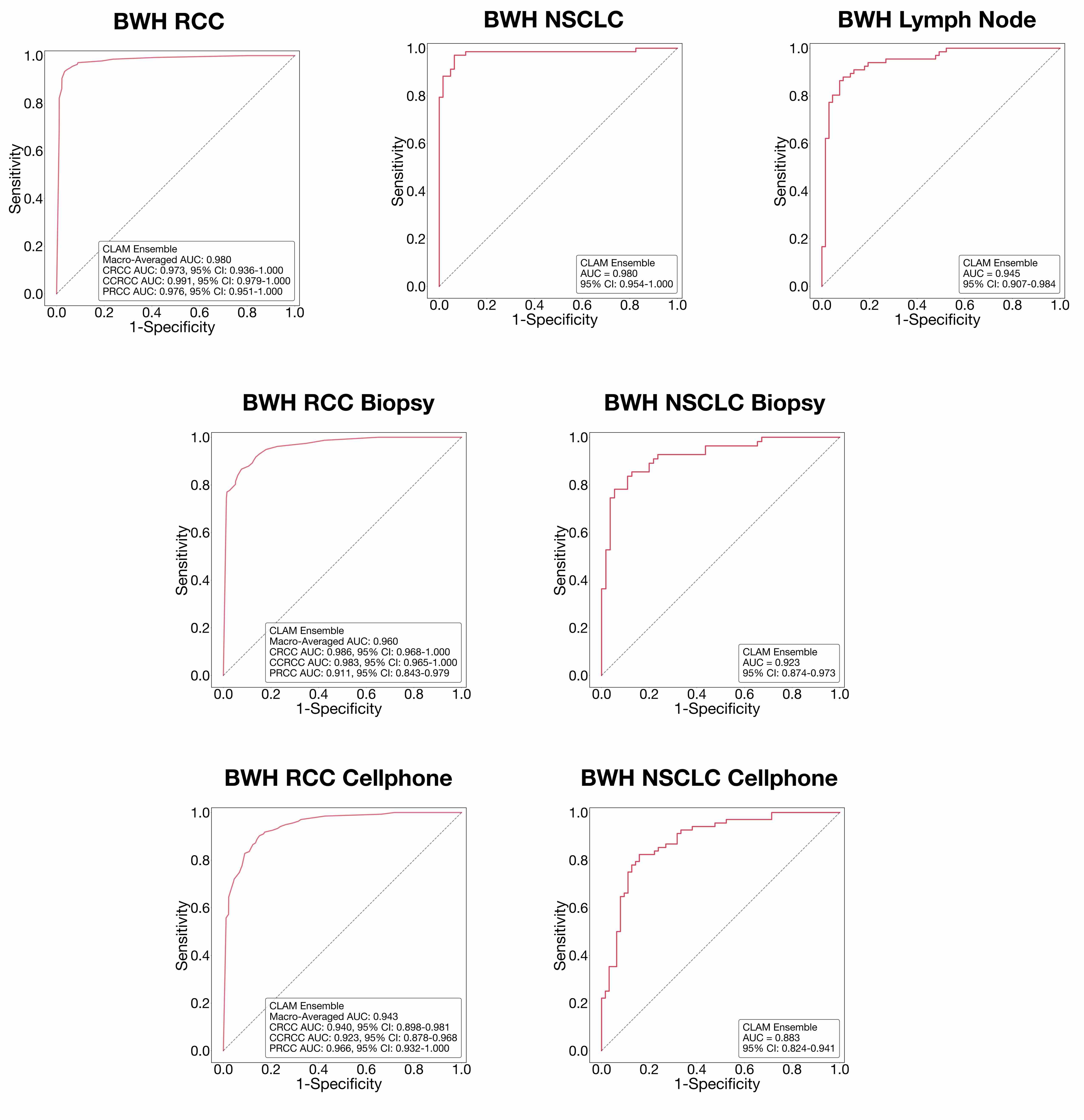 [2004.09666] Data Efficient and Weakly Supervised Computational Pathology on Whole Slide Images