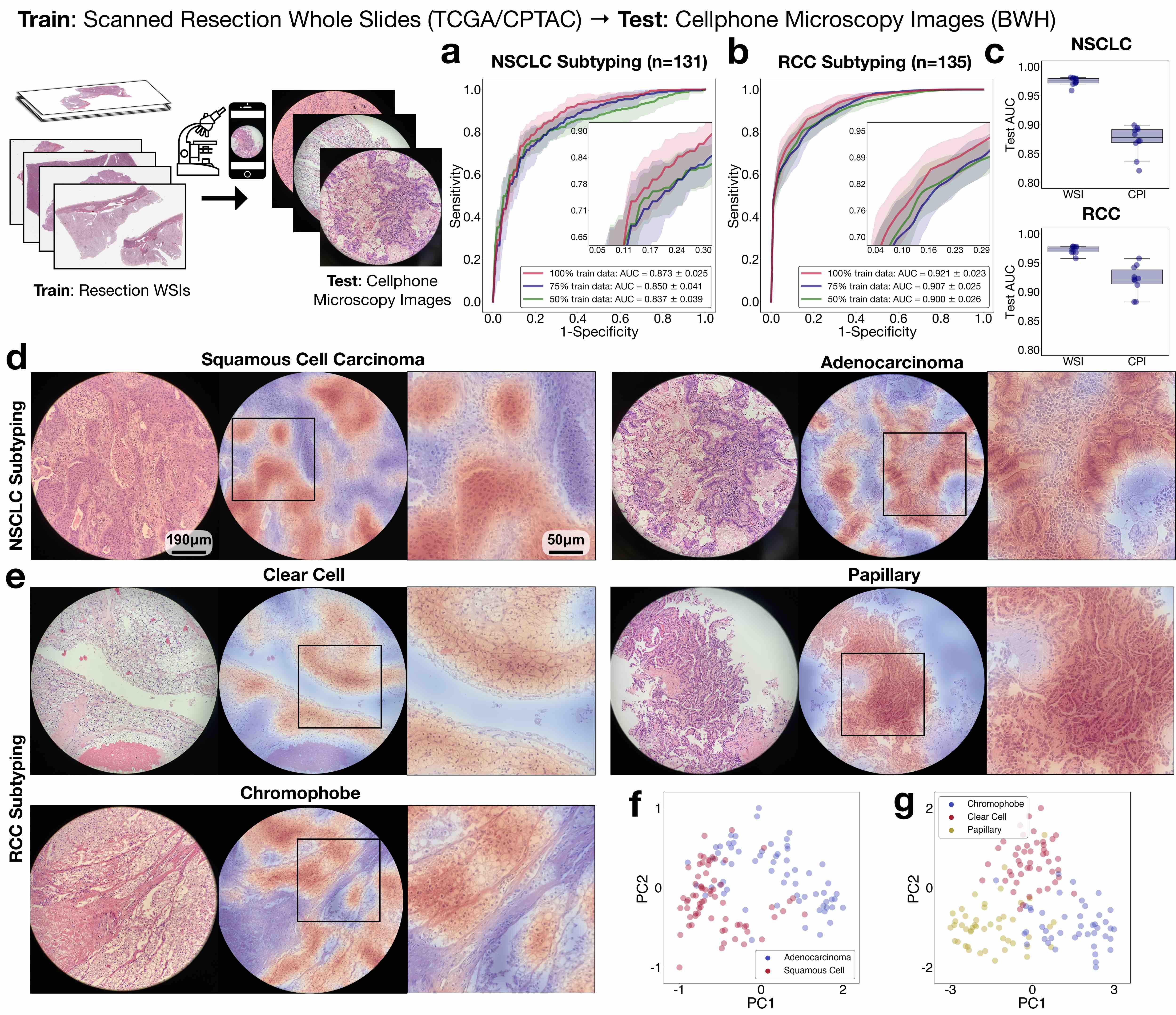 [2004.09666] Data Efficient and Weakly Supervised Computational Pathology on Whole Slide Images