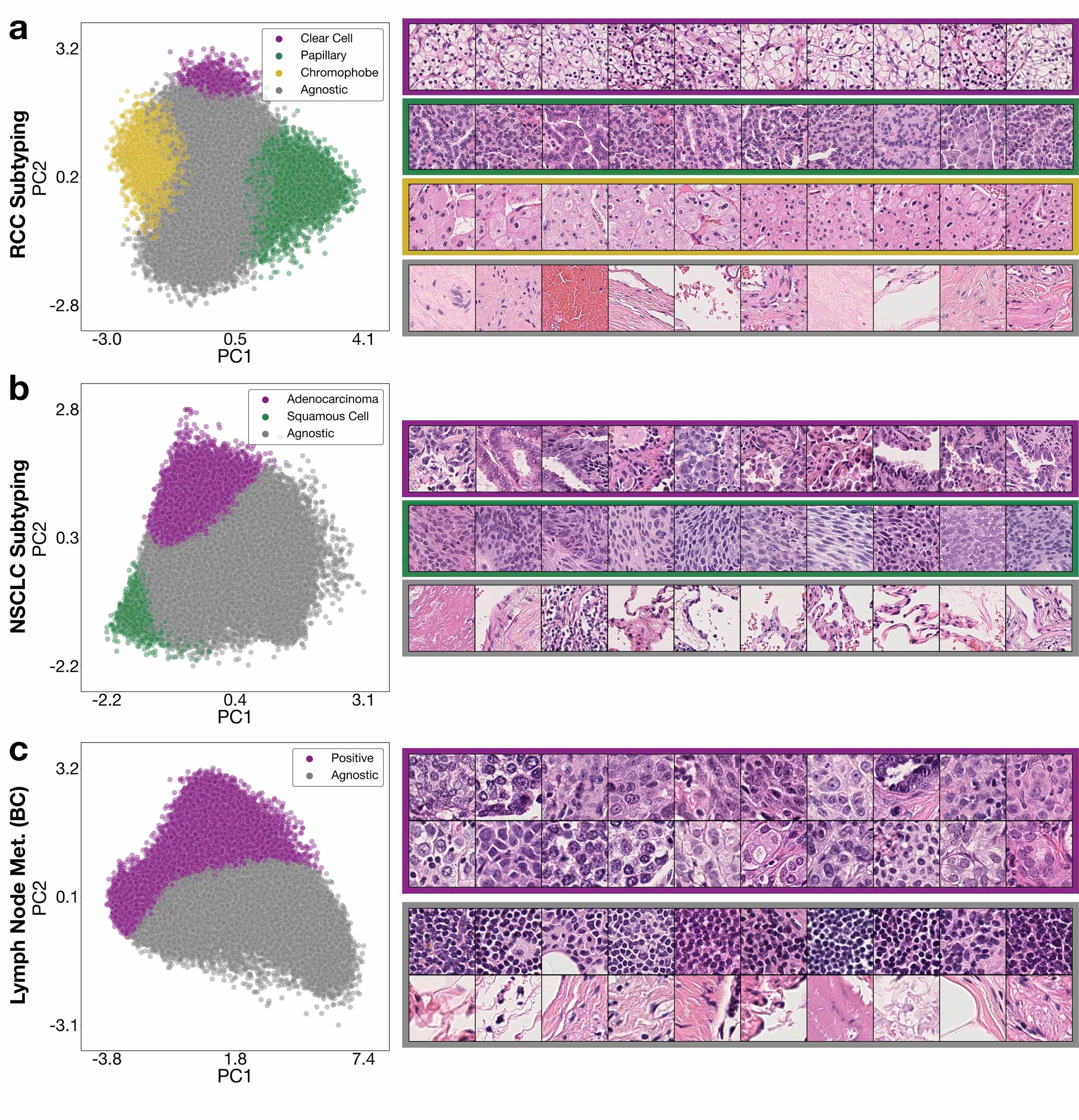 [2004.09666] Data Efficient and Weakly Supervised Computational Pathology on Whole Slide Images