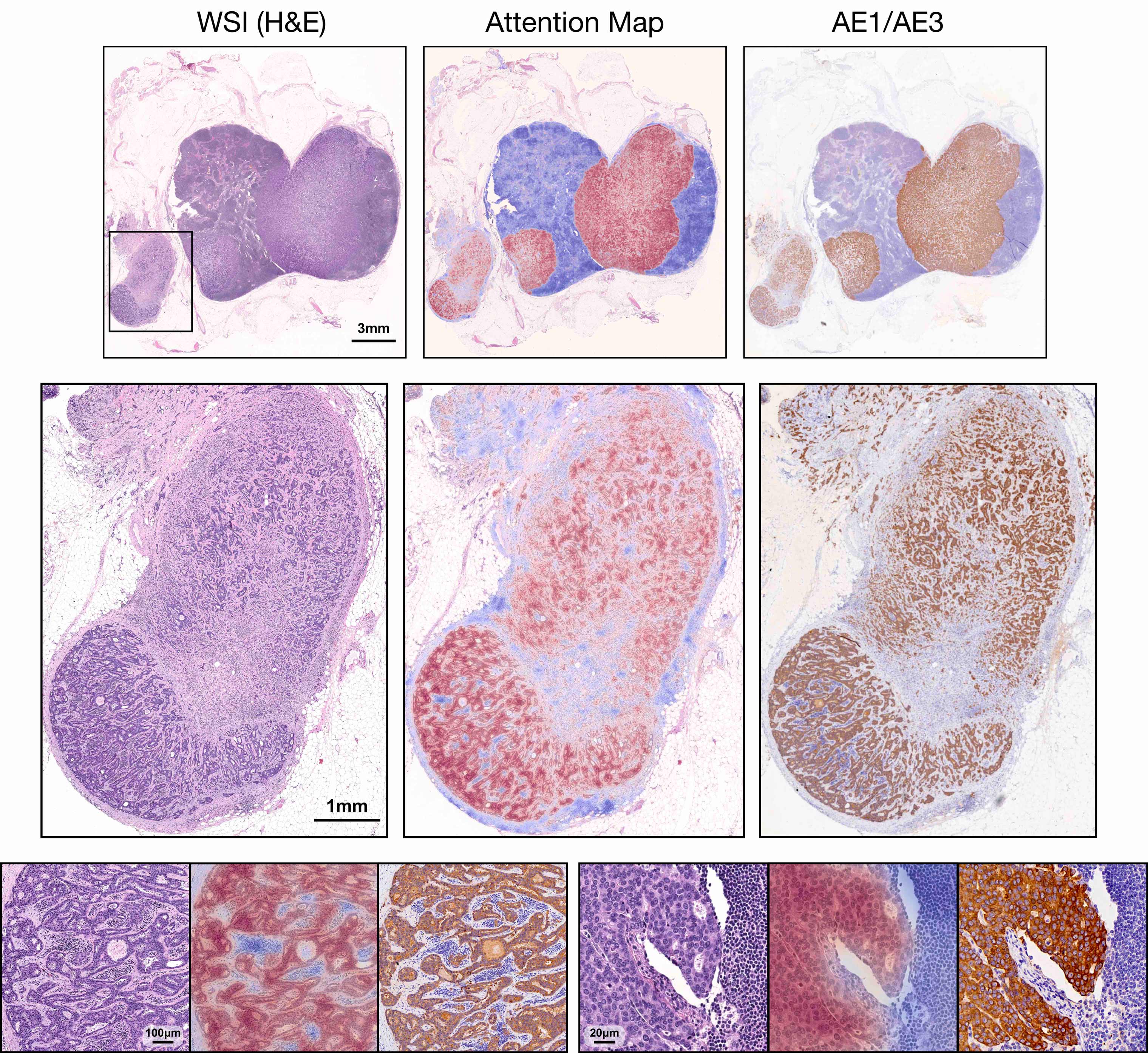 [2004.09666] Data Efficient and Weakly Supervised Computational Pathology on Whole Slide Images