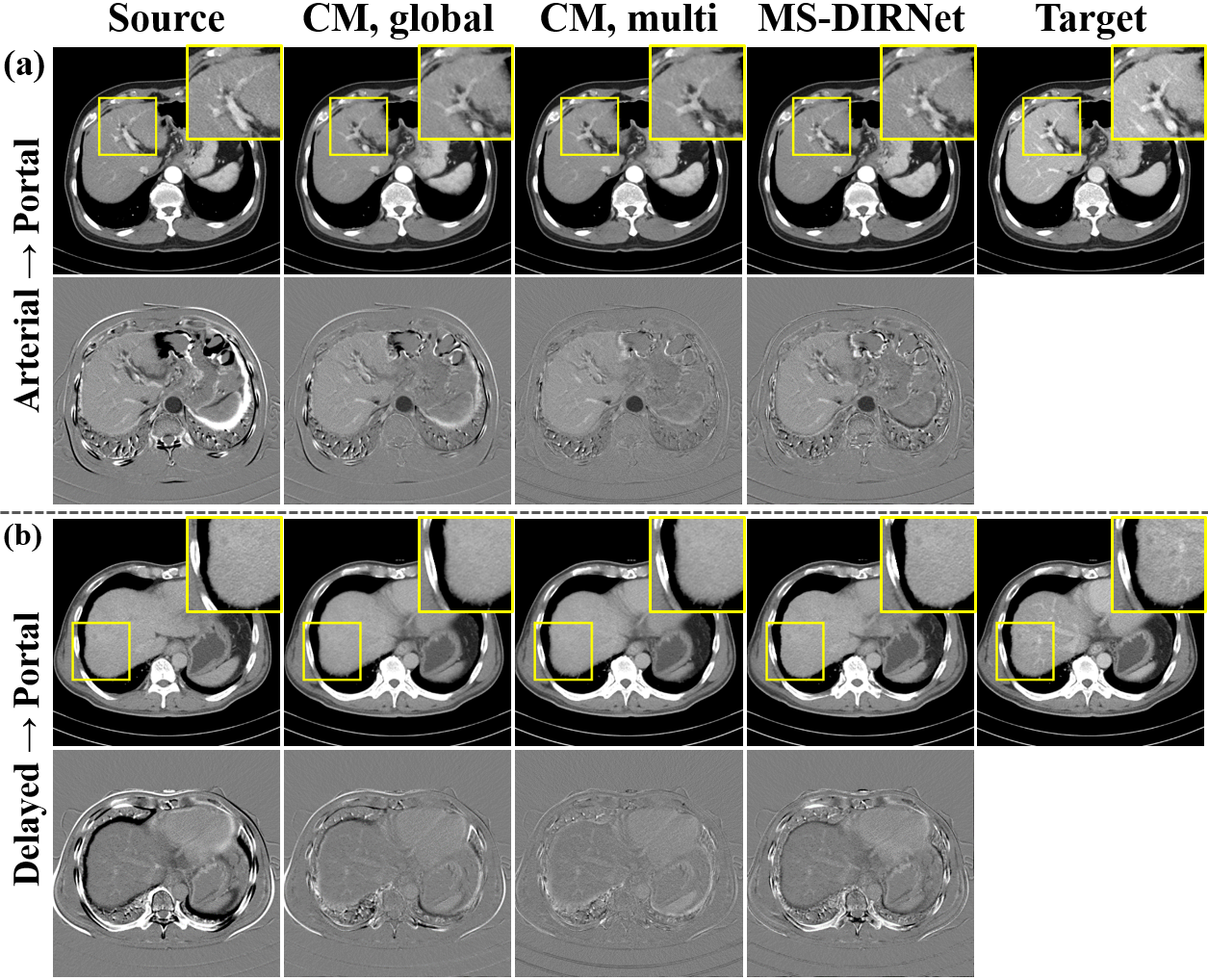 [2008.05772] CycleMorph: Cycle Consistent Unsupervised Deformable Image Registration