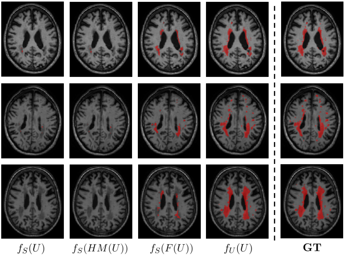 [2009.04985] Unsupervised Domain Adaptation via CycleGAN for White Matter Hyperintensity ...